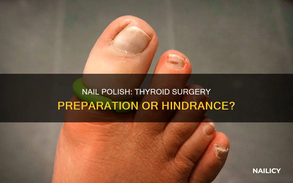 Nail Polish: Thyroid Surgery Preparation Or Hindrance? | Nailicy