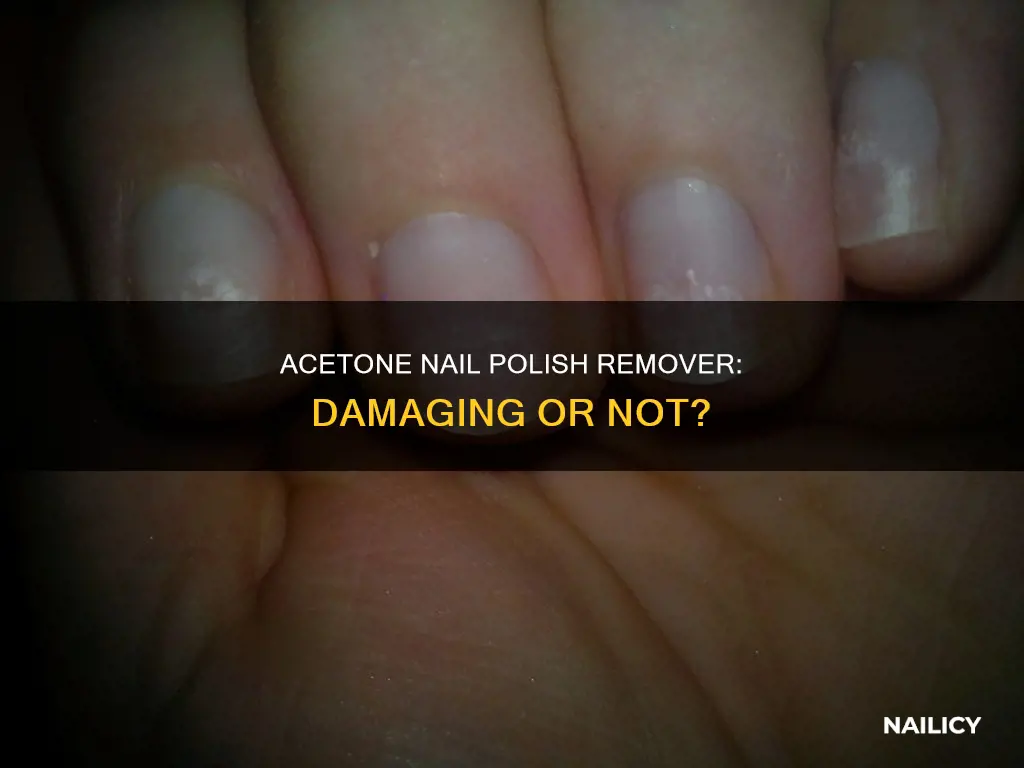 Acetone Nail Polish Remover: Damaging Or Not? | Nailicy