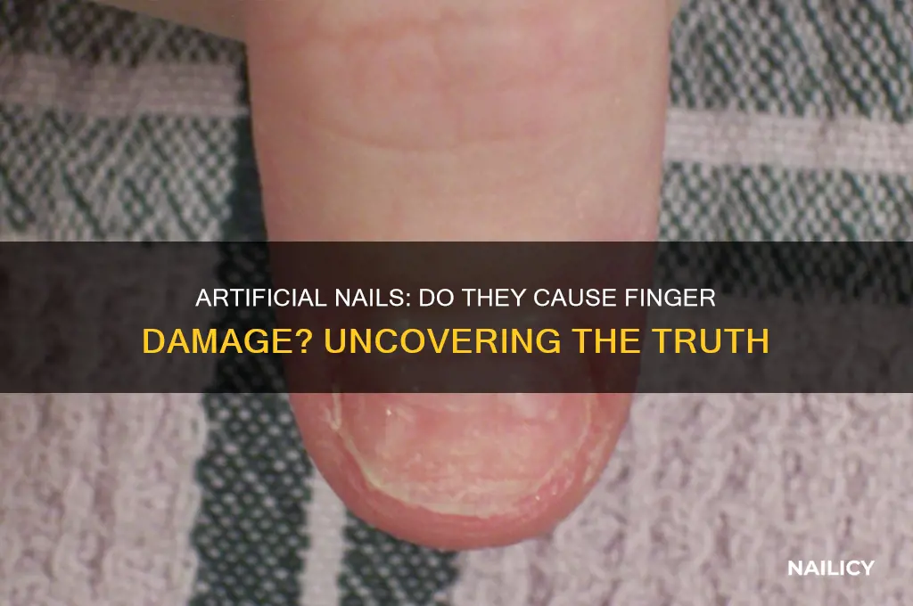 Artificial Nails: Do They Cause Finger Damage? Uncovering The Truth ...