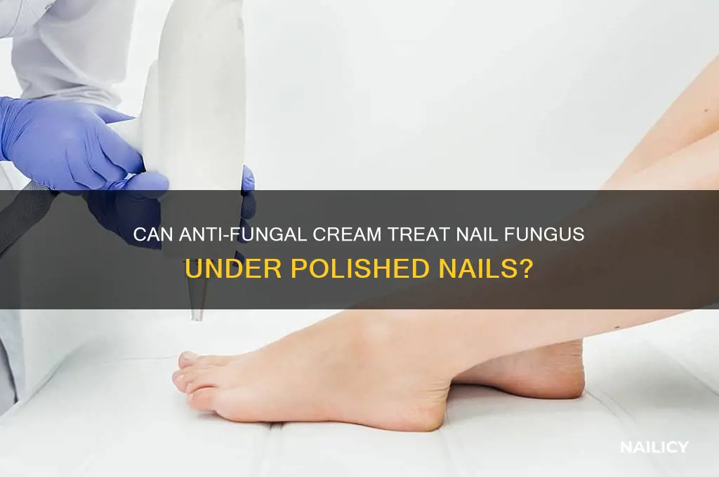 Can Anti-Fungal Cream Treat Nail Fungus Under Polished Nails? | Nailicy