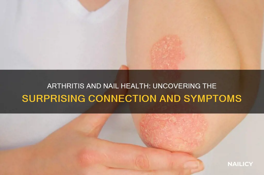 Arthritis And Nail Health: Uncovering The Surprising Connection And ...