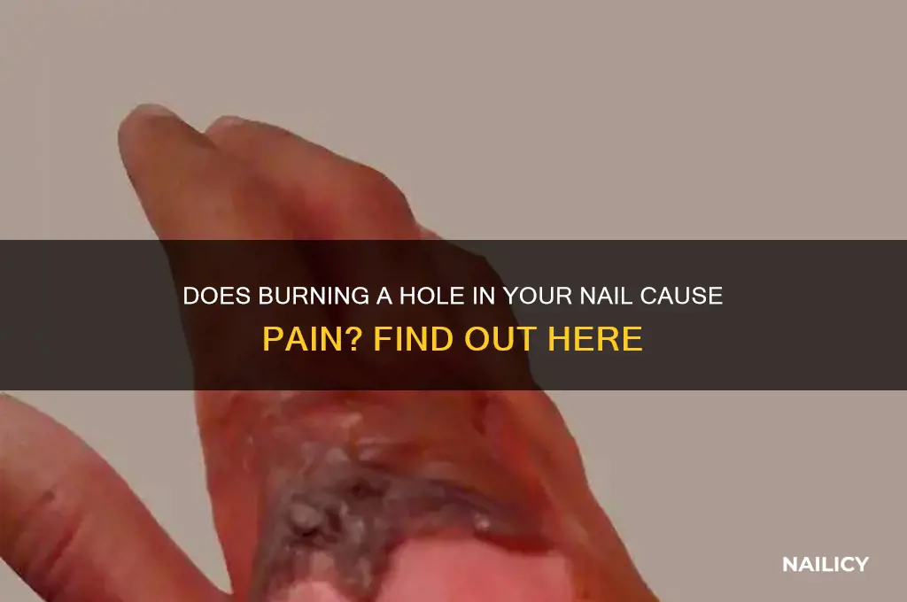 Does Burning A Hole In Your Nail Cause Pain? Find Out Here | Nailicy