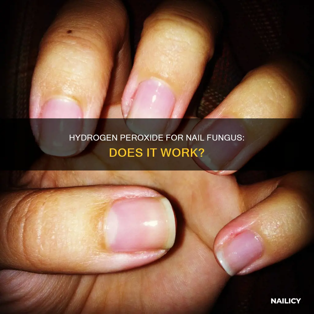 Hydrogen Peroxide For Nail Fungus: Does It Work? | Nailicy