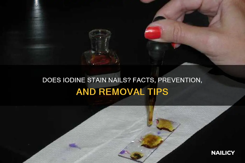 Does Iodine Stain Nails? Facts, Prevention, And Removal Tips | Nailicy