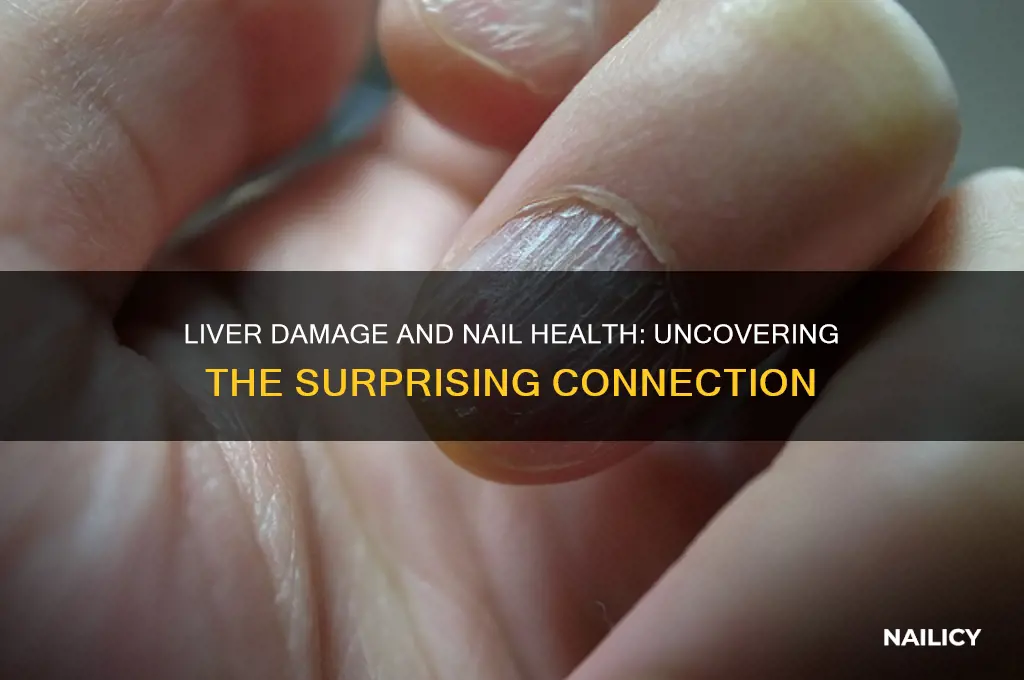 Liver Damage And Nail Health: Uncovering The Surprising Connection ...
