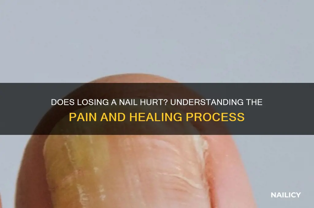 Does Losing A Nail Hurt? Understanding The Pain And Healing Process ...