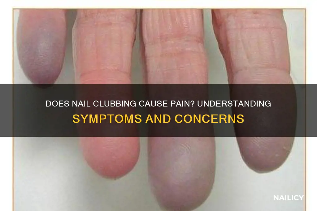 Does Nail Clubbing Cause Pain? Understanding Symptoms And Concerns ...