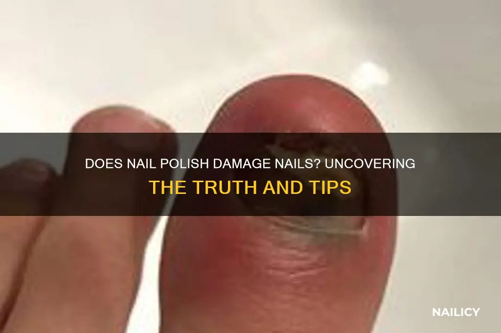 Does Nail Polish Damage Nails? Uncovering The Truth And Tips | Nailicy