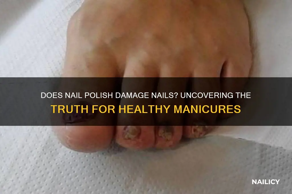 Does Nail Polish Damage Nails? Uncovering The Truth For Healthy ...