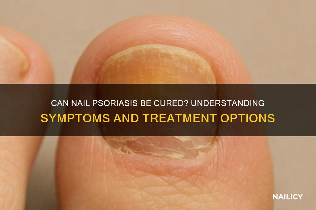 Can Nail Psoriasis Be Cured? Understanding Symptoms And Treatment ...
