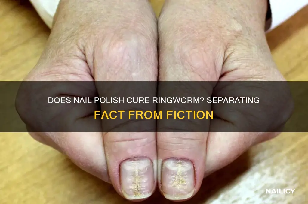 Does Nail Polish Cure Ringworm? Separating Fact From Fiction | Nailicy