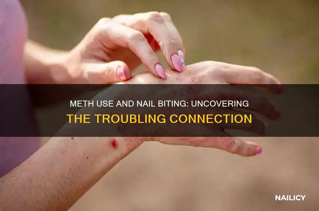 Meth Use And Nail Biting: Uncovering The Troubling Connection | Nailicy