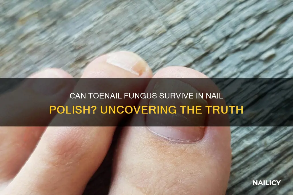 Can Toenail Fungus Survive In Nail Polish? Uncovering The Truth | Nailicy