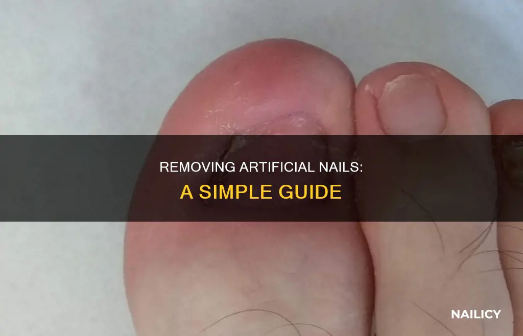 Removing Artificial Nails: A Simple Guide | Nailicy