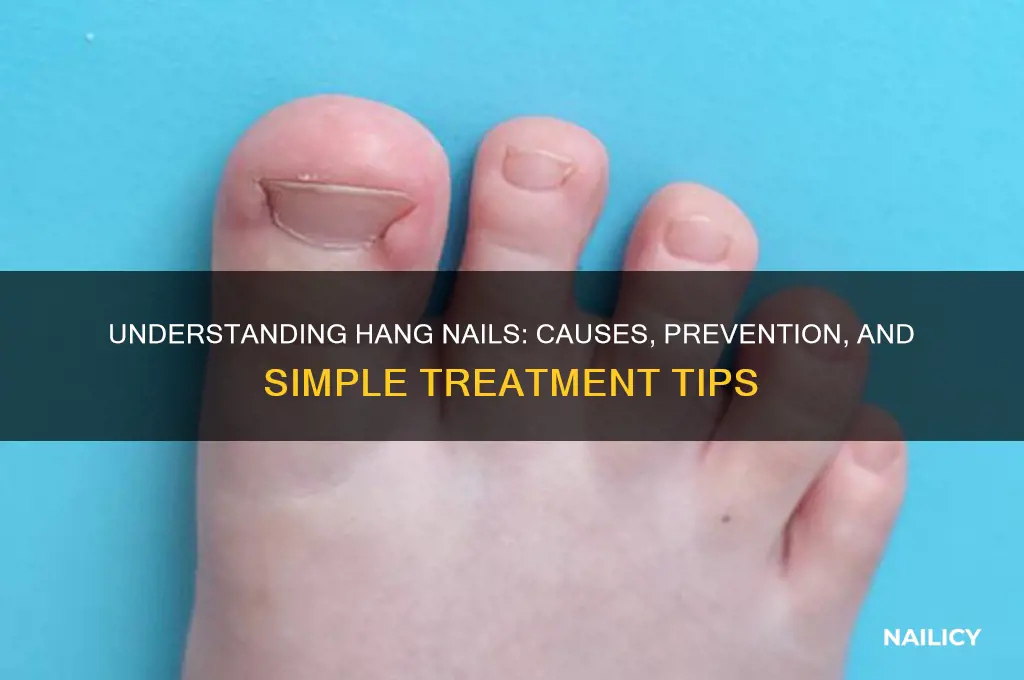 Understanding Hang Nails: Causes, Prevention, And Simple Treatment Tips ...