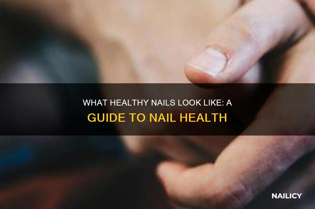 What Healthy Nails Look Like: A Guide To Nail Health | Nailicy