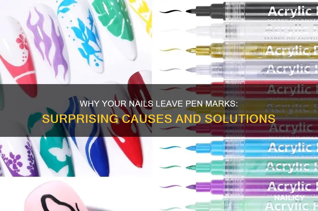 Why Your Nails Leave Pen Marks: Surprising Causes And Solutions | Nailicy