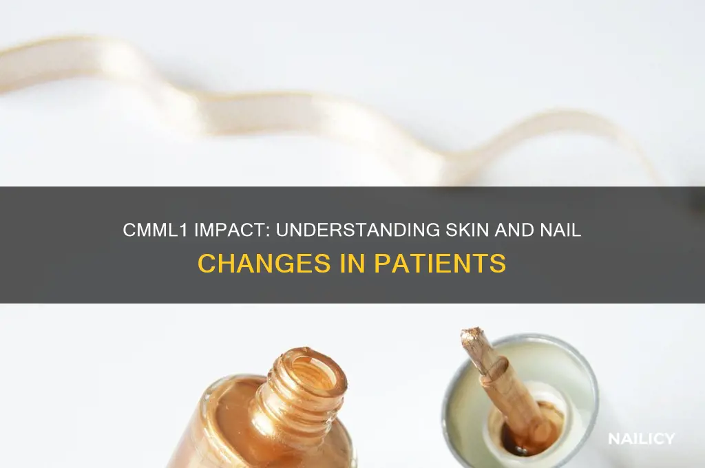 Cmml1 Impact: Understanding Skin And Nail Changes In Patients | Nailicy