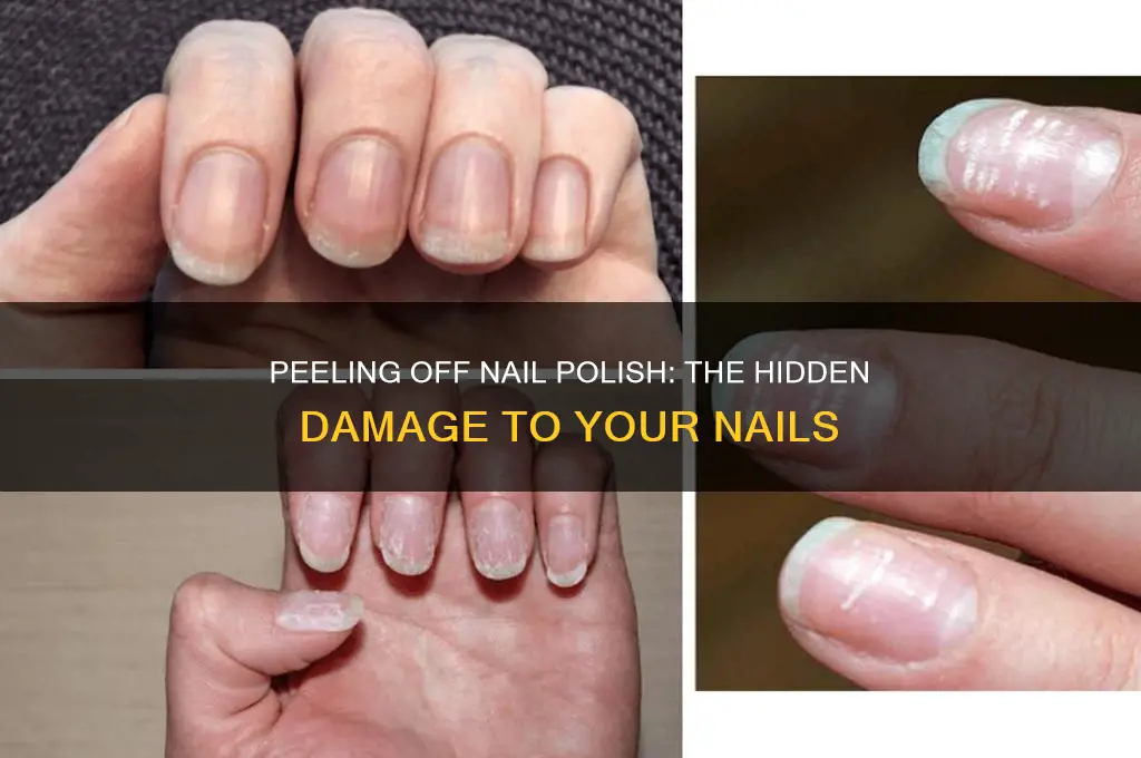 Peeling Off Nail Polish: The Hidden Damage To Your Nails | Nailicy