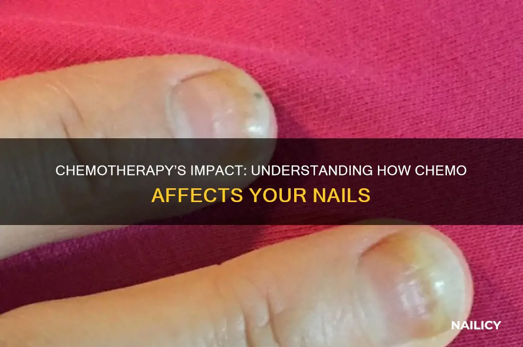 Chemotherapy’S Impact: Understanding How Chemo Affects Your Nails | Nailicy