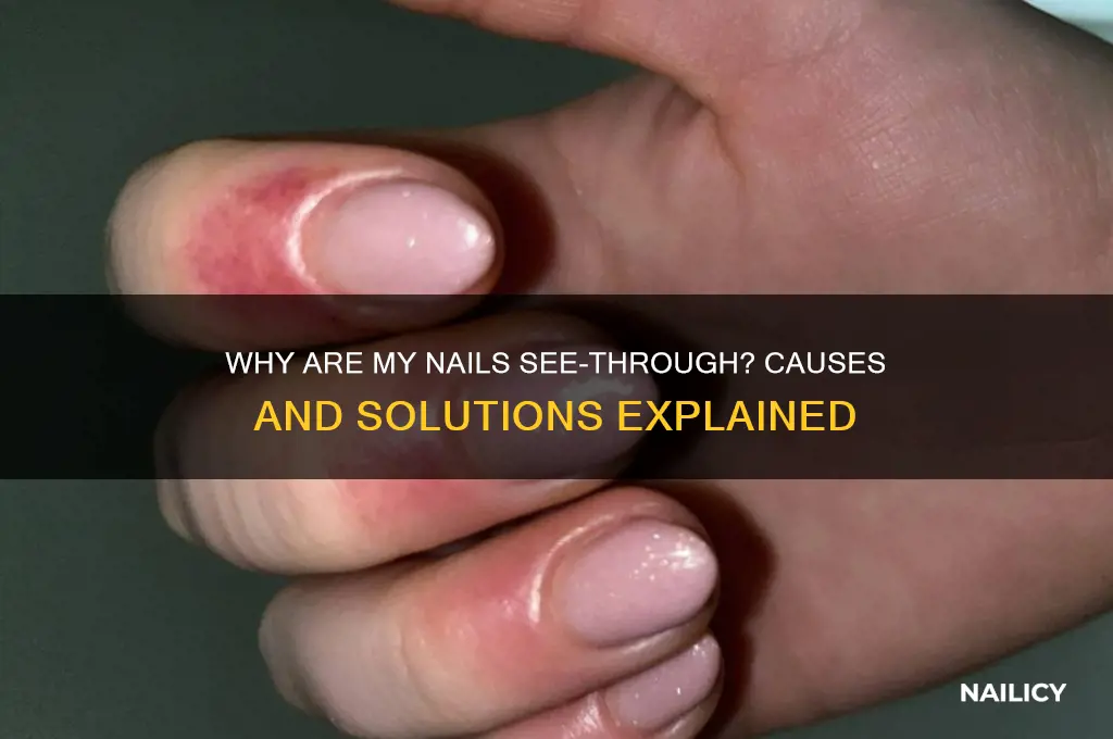 Why Are My Nails See-Through? Causes And Solutions Explained | Nailicy