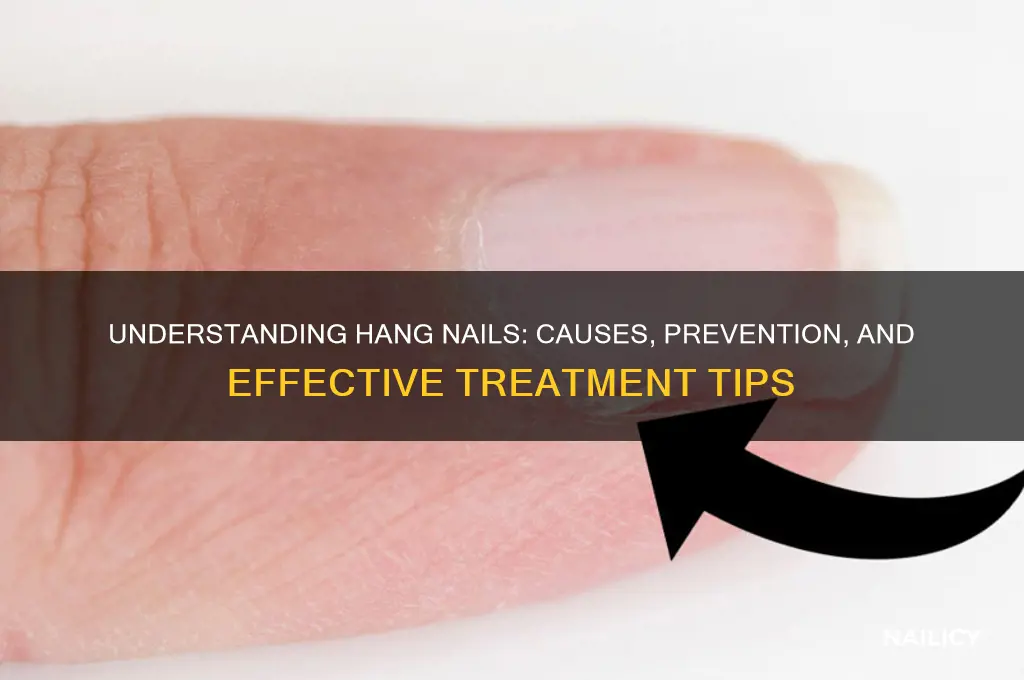 Understanding Hang Nails: Causes, Prevention, And Effective Treatment ...