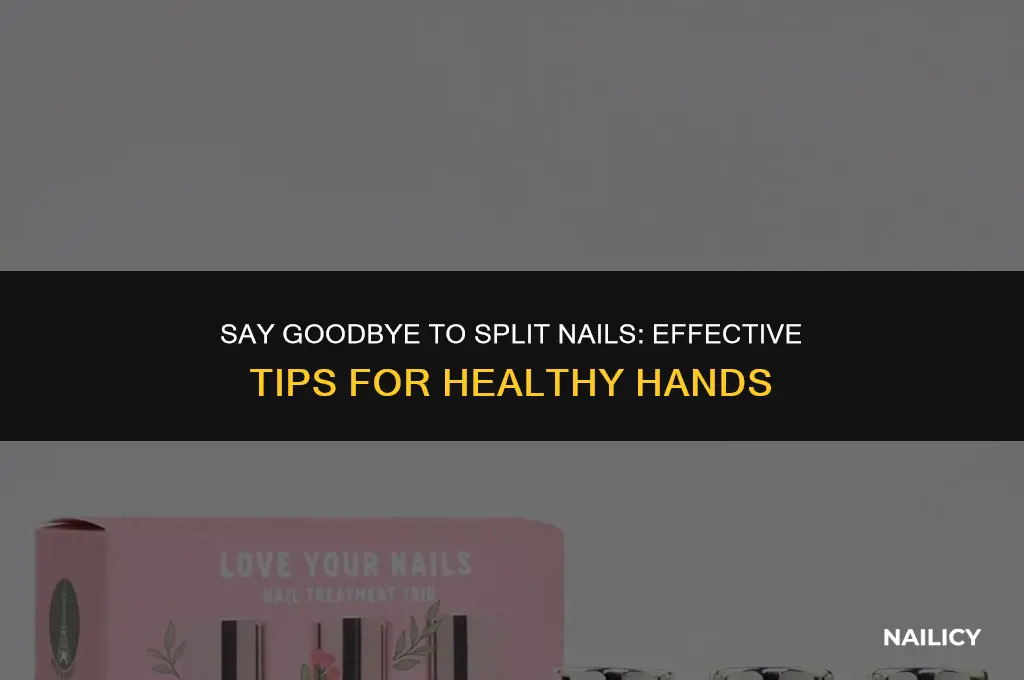 Say Goodbye To Split Nails: Effective Tips For Healthy Hands | Nailicy