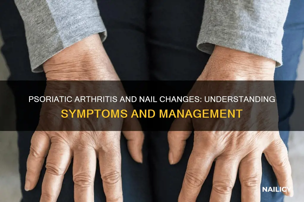 Psoriatic Arthritis And Nail Changes: Understanding Symptoms And ...