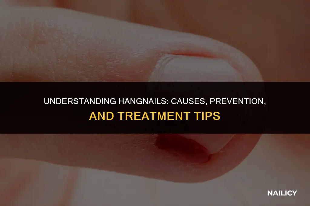 Understanding Hangnails: Causes, Prevention, And Treatment Tips | Nailicy