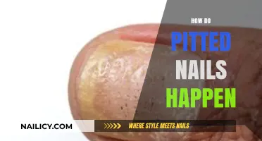 Understanding Pitted Nails: Causes, Symptoms, And Treatment Options ...