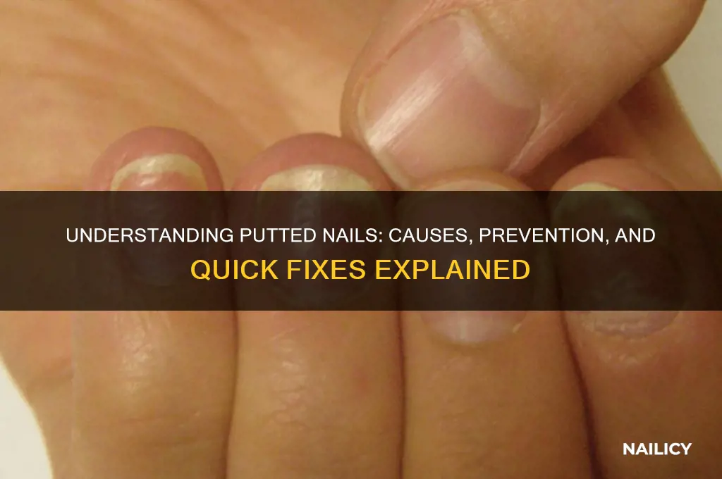 Understanding Putted Nails: Causes, Prevention, And Quick Fixes ...