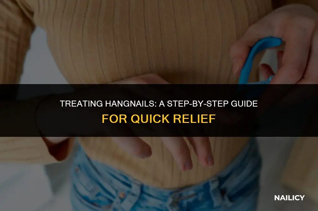 Treating Hangnails: A Step-By-Step Guide For Quick Relief | Nailicy