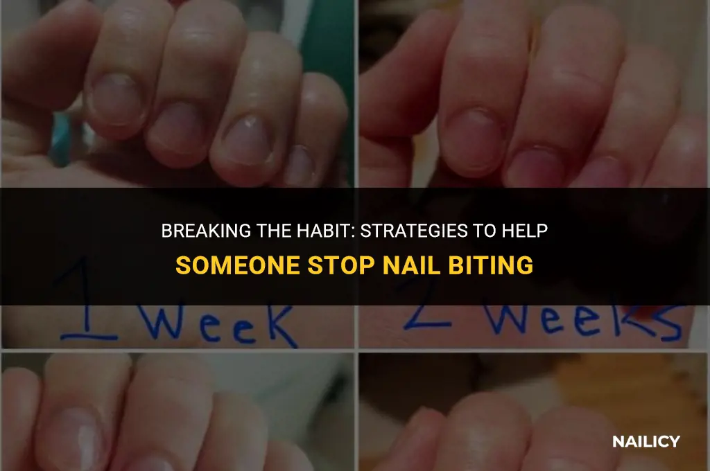 Breaking The Habit: Strategies To Help Someone Stop Nail Biting | Nailicy