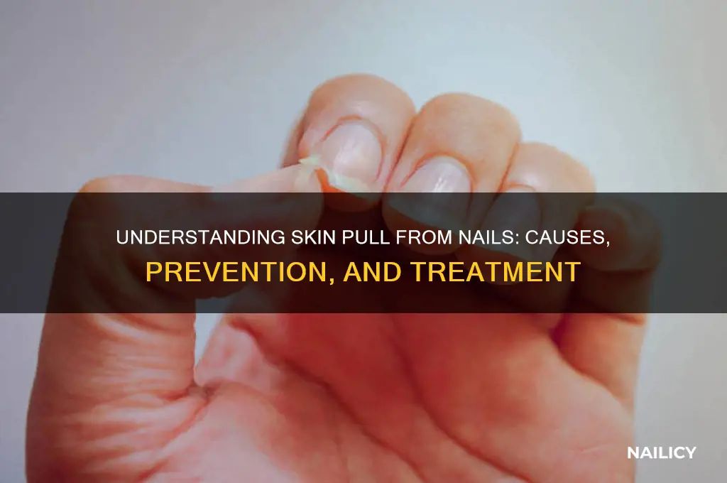Understanding Skin Pull From Nails: Causes, Prevention, And Treatment ...