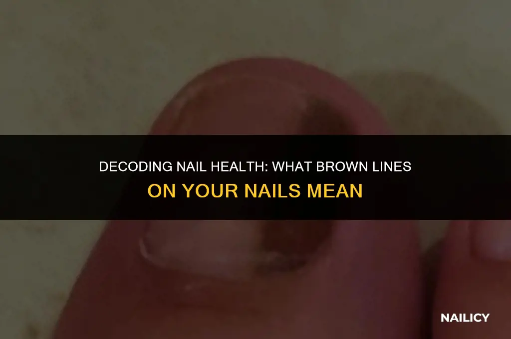 Decoding Nail Health: What Brown Lines On Your Nails Mean | Nailicy
