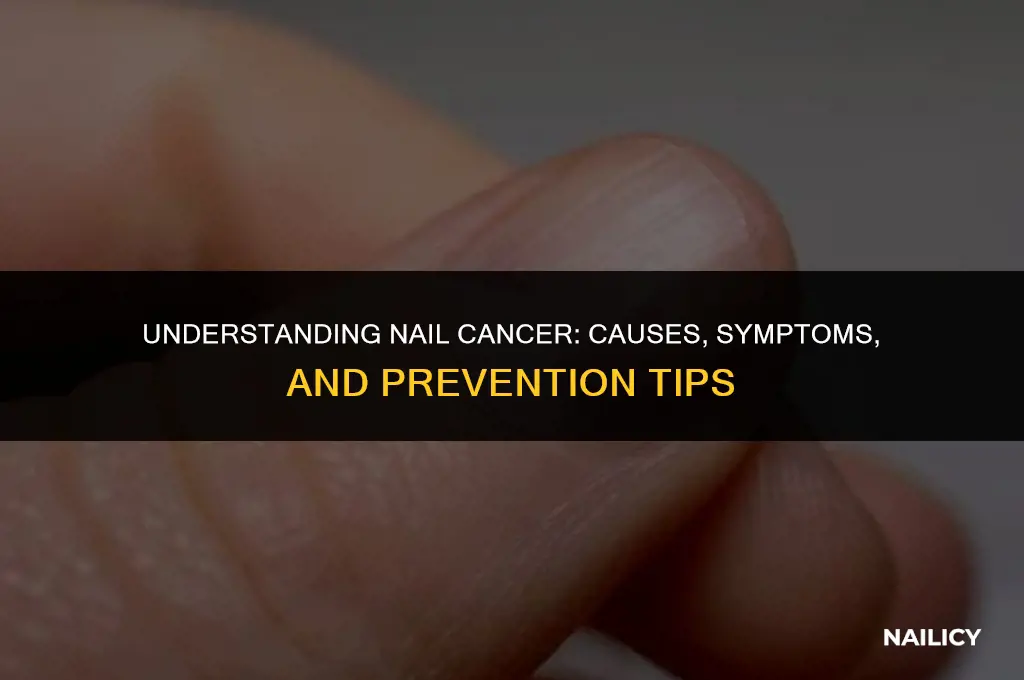 Understanding Nail Cancer: Causes, Symptoms, And Prevention Tips | Nailicy