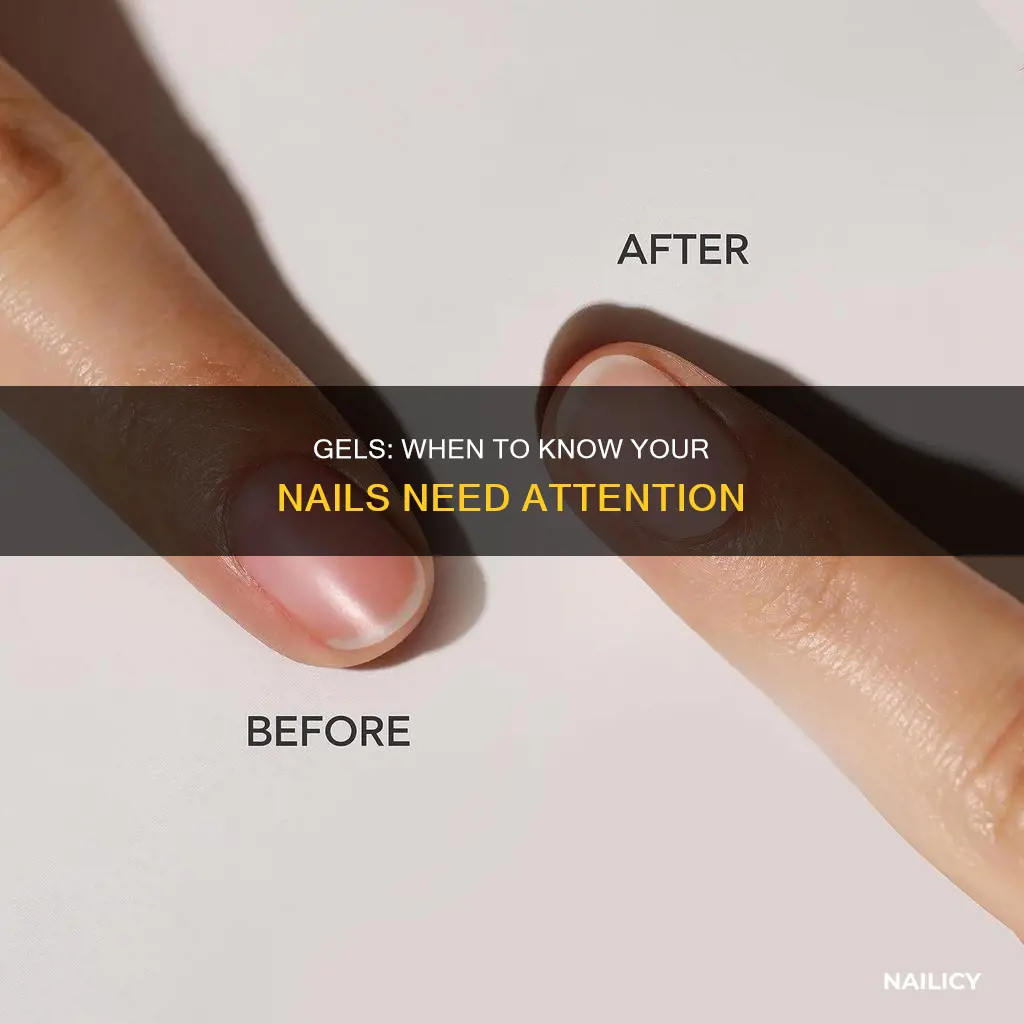 Gels: When To Know Your Nails Need Attention | Nailicy