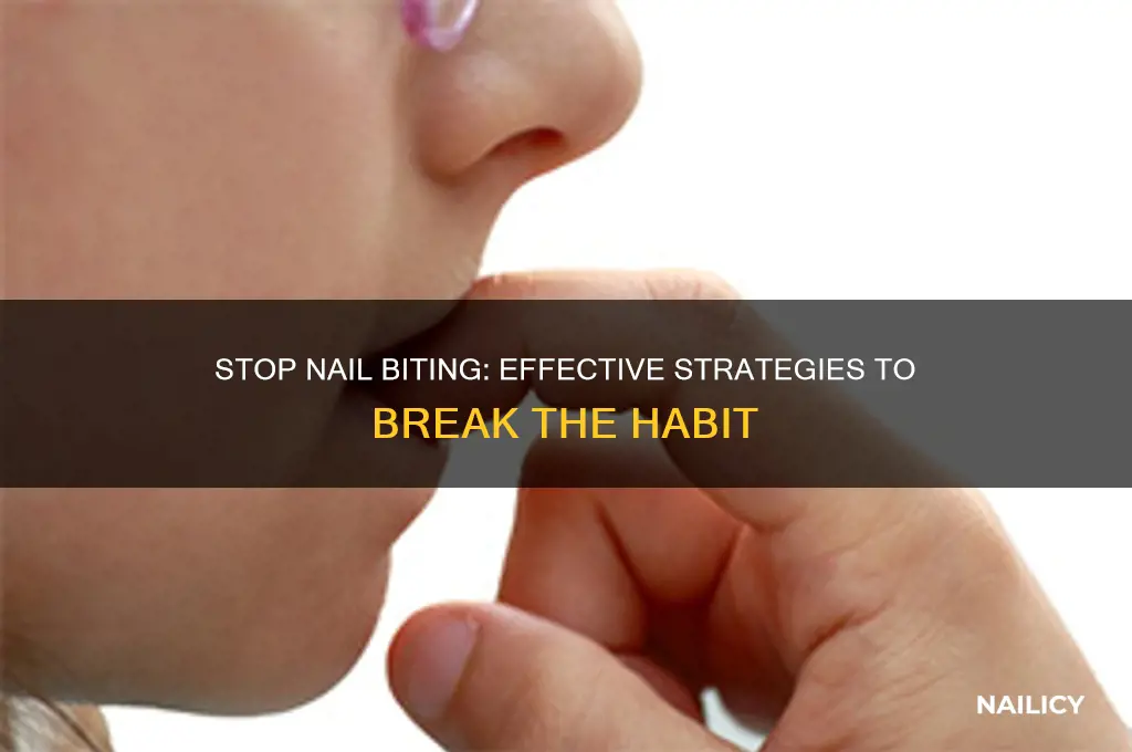Stop Nail Biting: Effective Strategies To Break The Habit | Nailicy