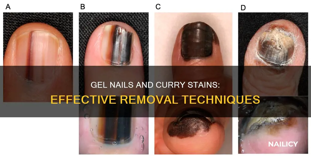 Gel Nails And Curry Stains: Effective Removal Techniques | Nailicy