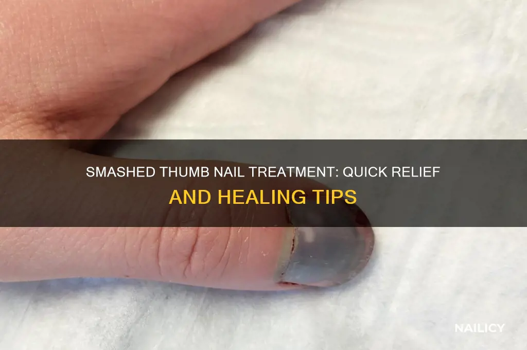 Smashed Thumb Nail Treatment: Quick Relief And Healing Tips | Nailicy