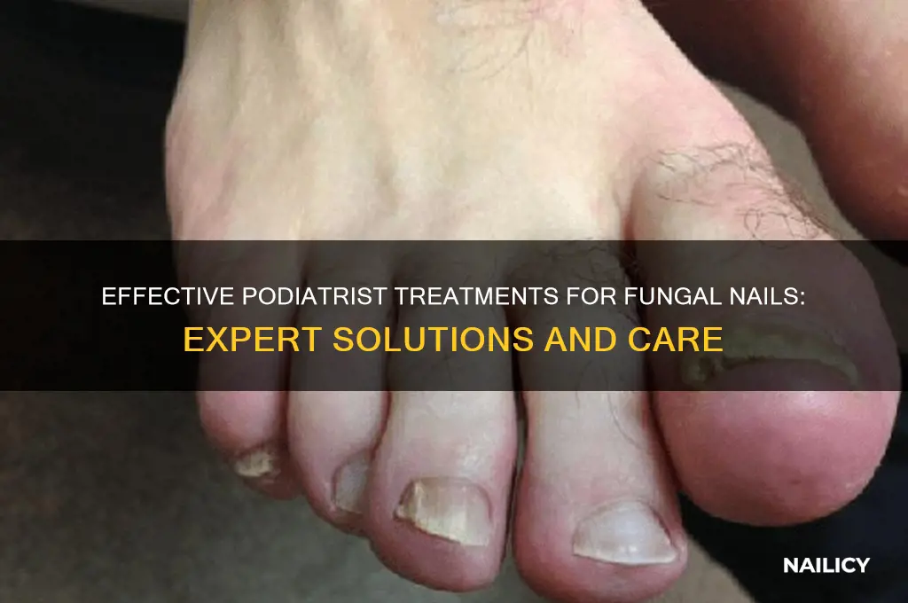 Effective Podiatrist Treatments For Fungal Nails: Expert Solutions And ...