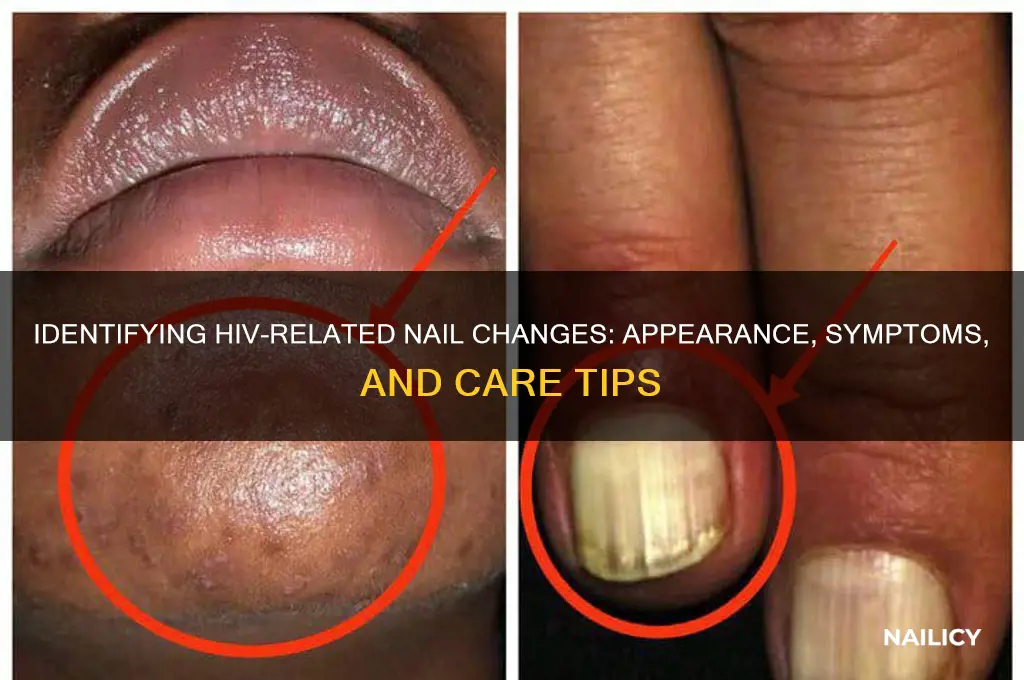 Identifying Hiv-Related Nail Changes: Appearance, Symptoms, And Care ...