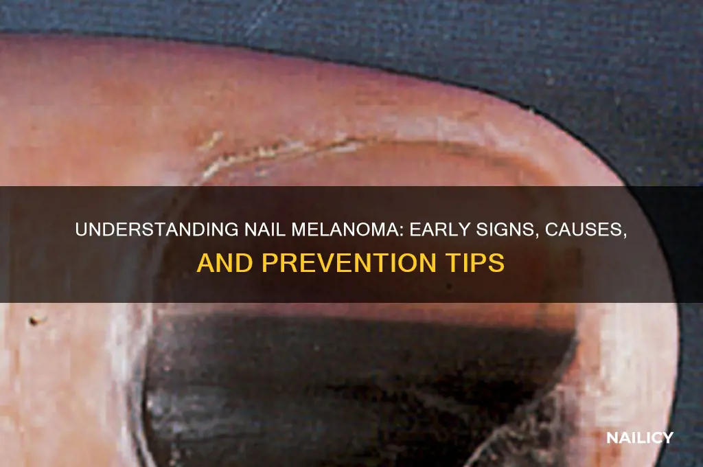 Understanding Nail Melanoma: Early Signs, Causes, And Prevention Tips ...
