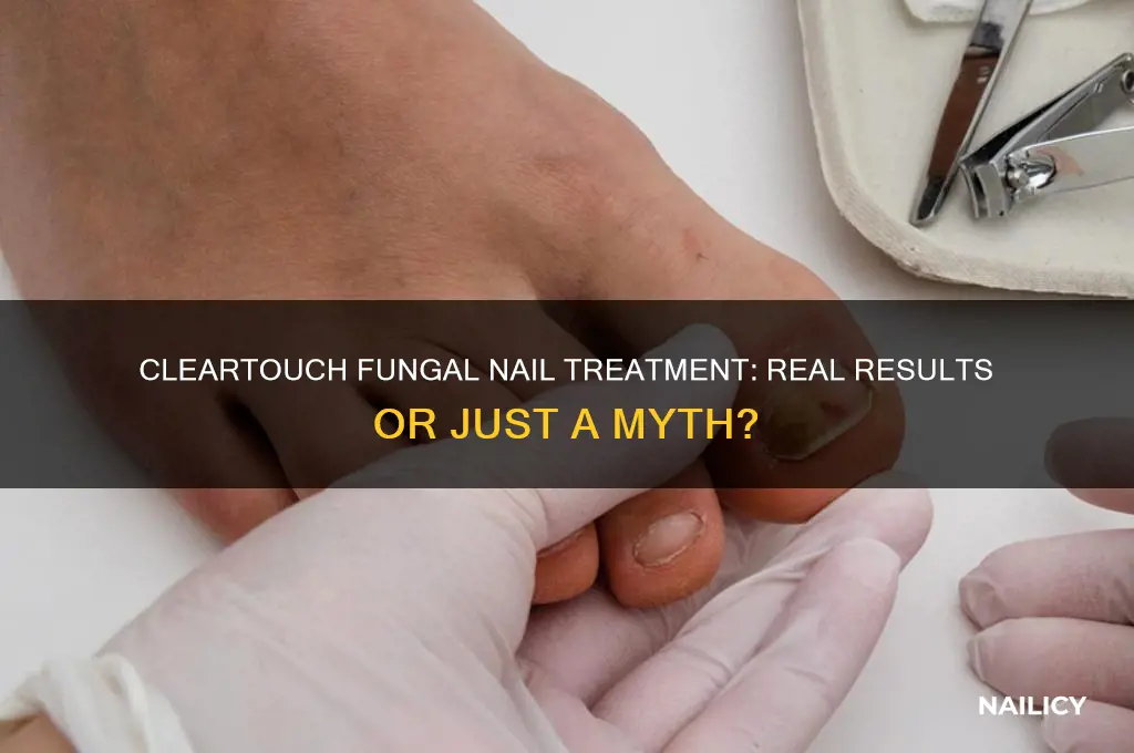 Cleartouch Fungal Nail Treatment: Real Results Or Just A Myth? | Nailicy