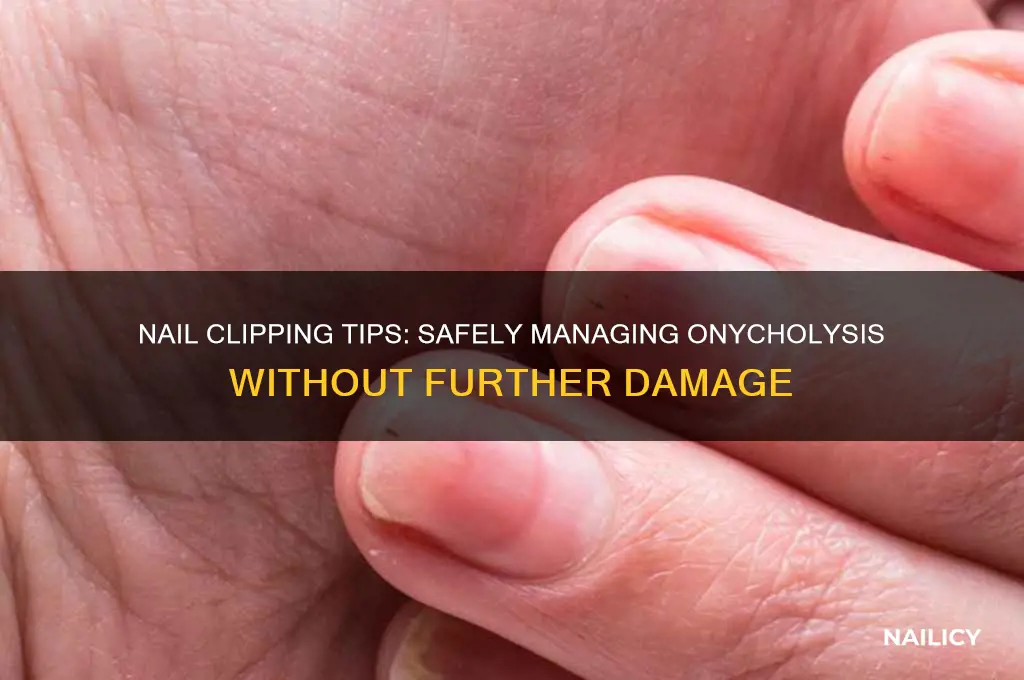 Nail Clipping Tips: Safely Managing Onycholysis Without Further Damage ...