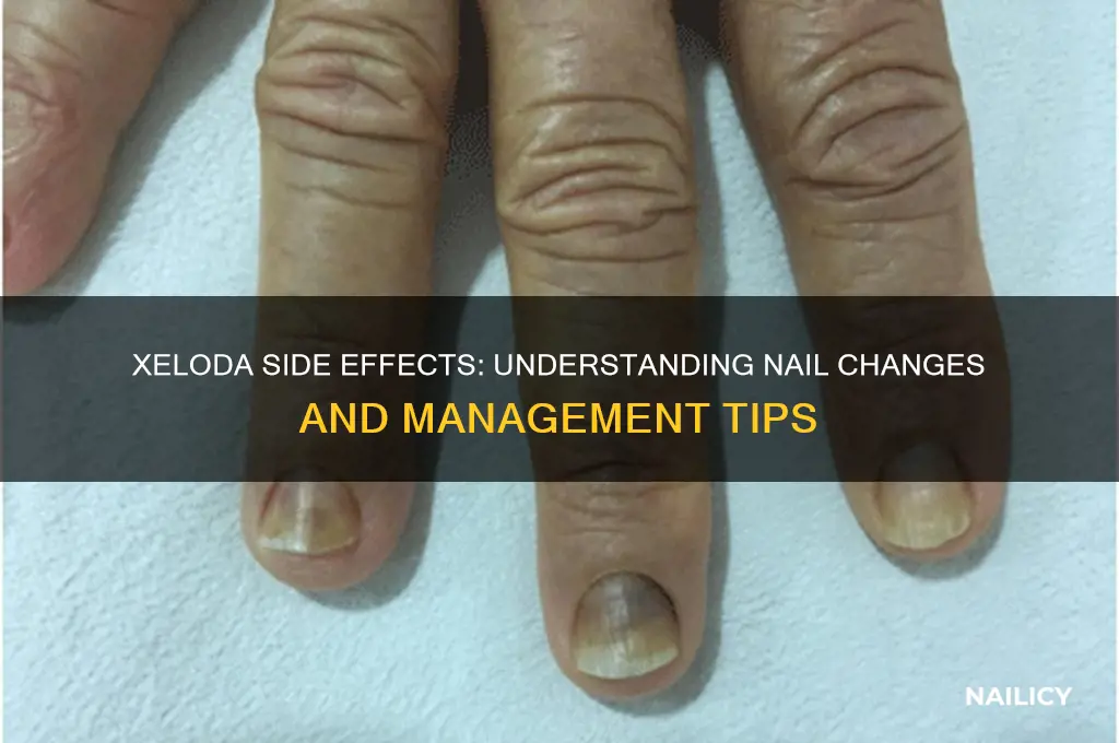Xeloda Side Effects: Understanding Nail Changes And Management Tips ...