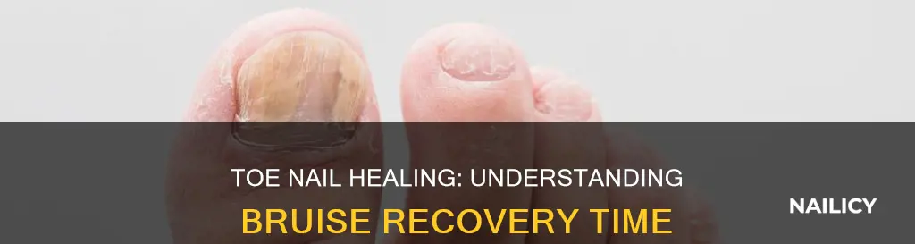 Toe Nail Healing: Understanding Bruise Recovery Time | Nailicy