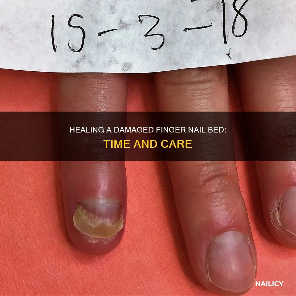 Healing A Damaged Finger Nail Bed: Time And Care | Nailicy
