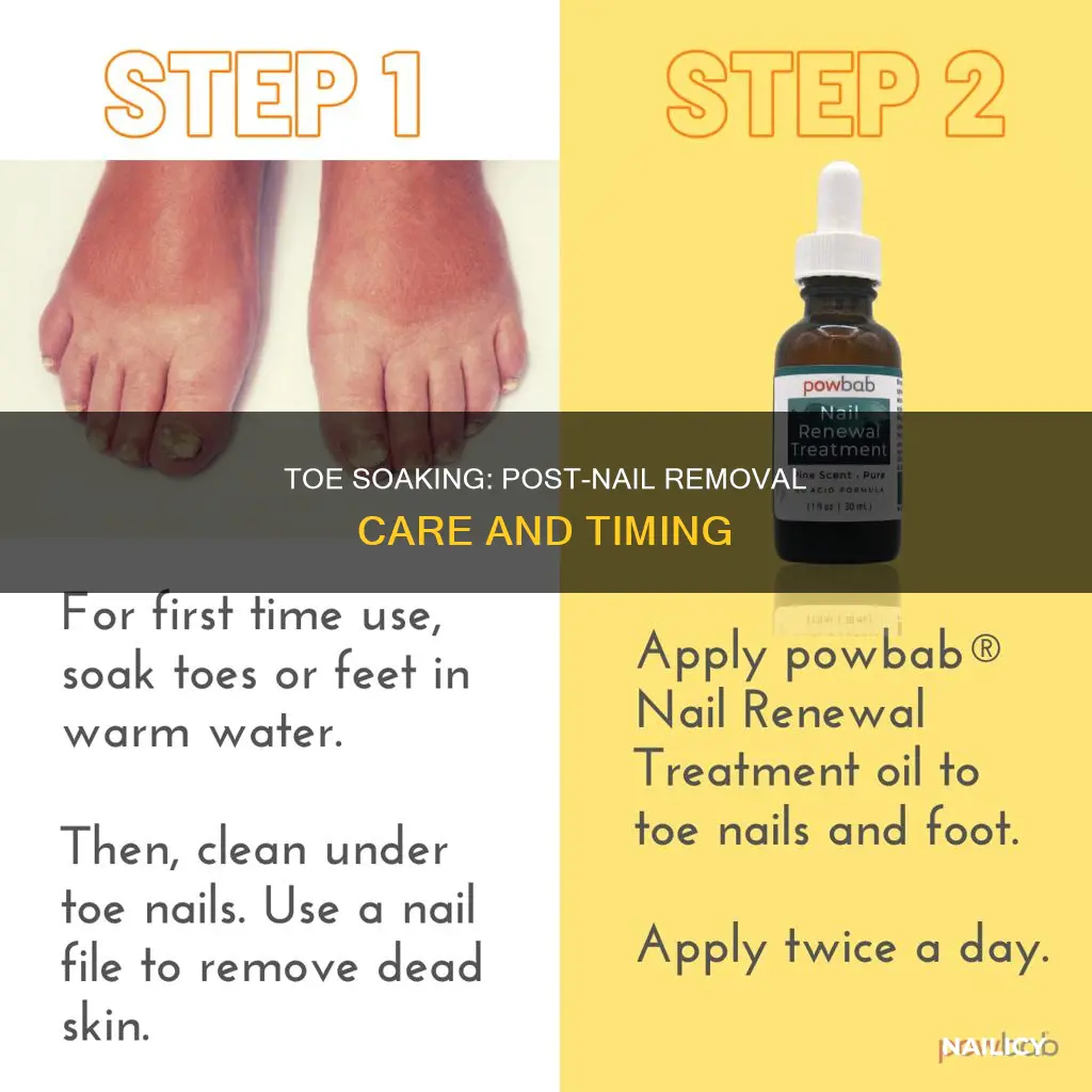 Toe Soaking: Post-Nail Removal Care And Timing | Nailicy