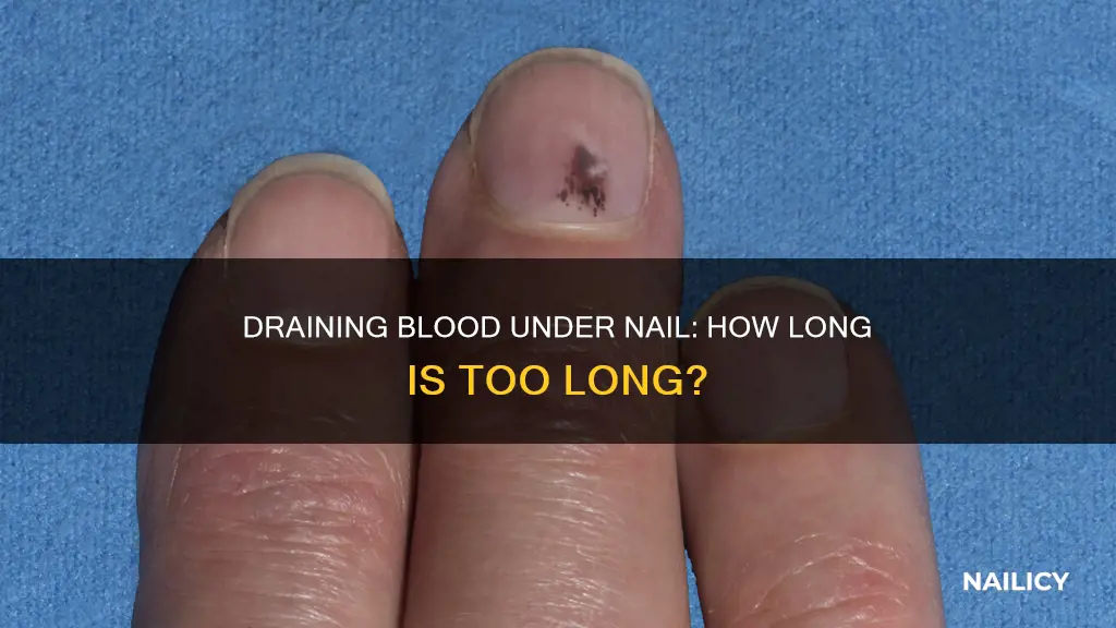 Draining Blood Under Nail: How Long Is Too Long? | Nailicy